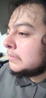 I'm the example of berid phenotype. | Anthro World Forum